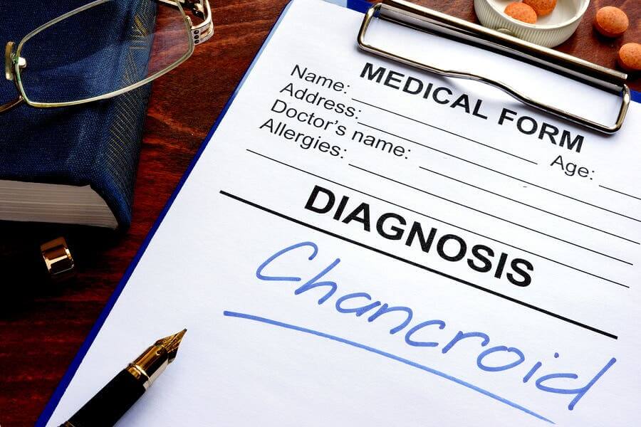 Chancre mou : symptômes et traitement - Améliore ta Santé