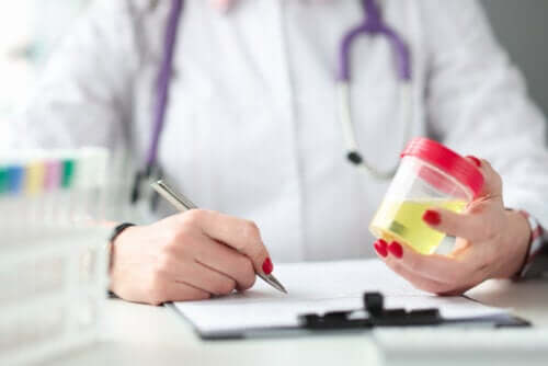 Test urinaire d'urée et de créatinine : que signifient les résultats ...